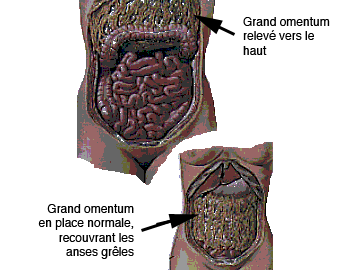 Peritoine